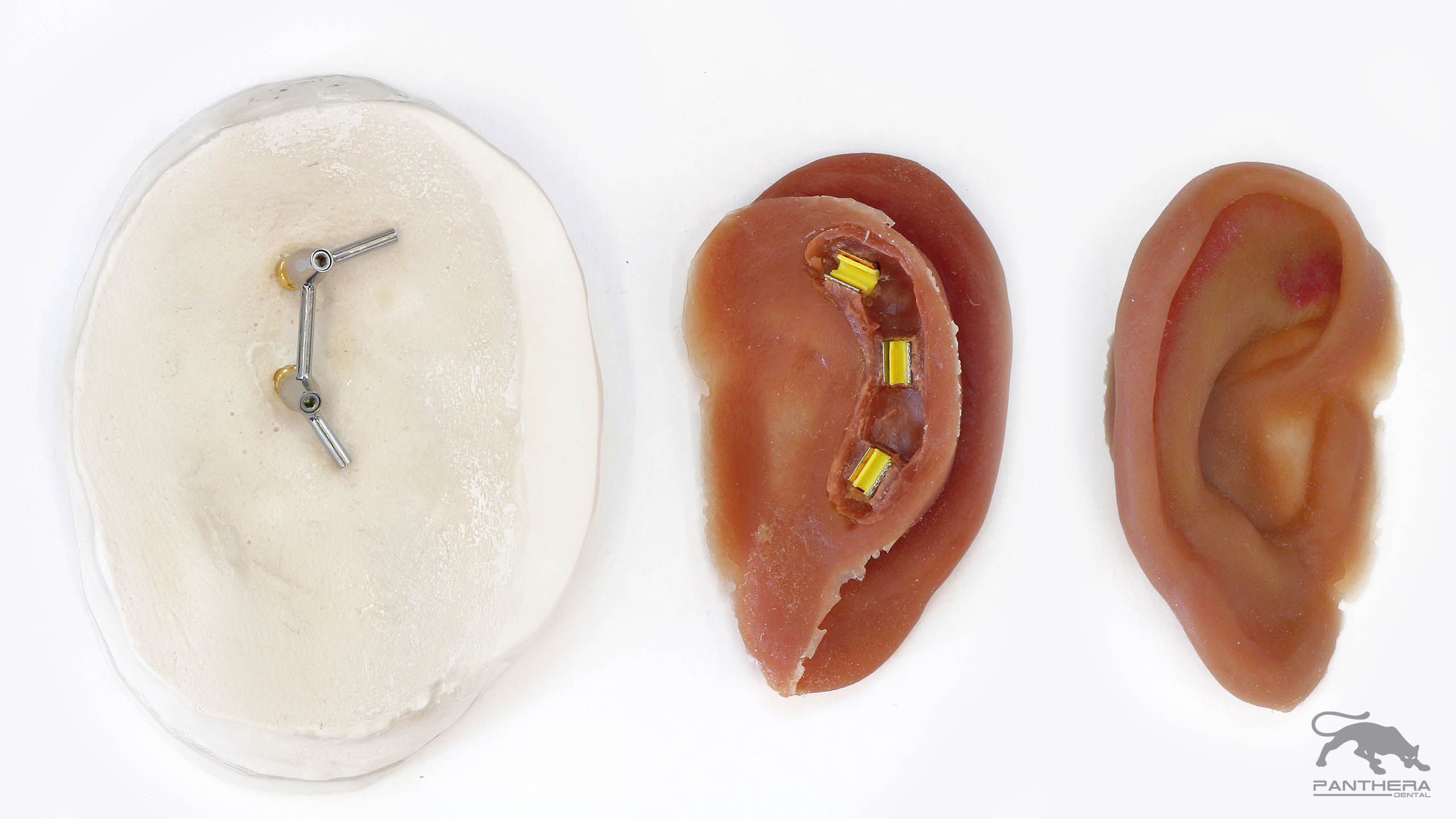 Ears cases - Panthera Implant