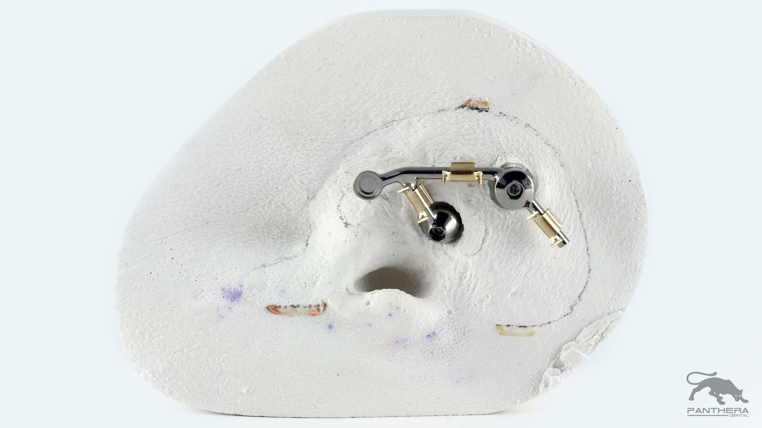 Ears cases - Panthera Implant